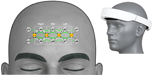 NeurotechEU UMH » Newmanbrain, technology behind brain diagnostics